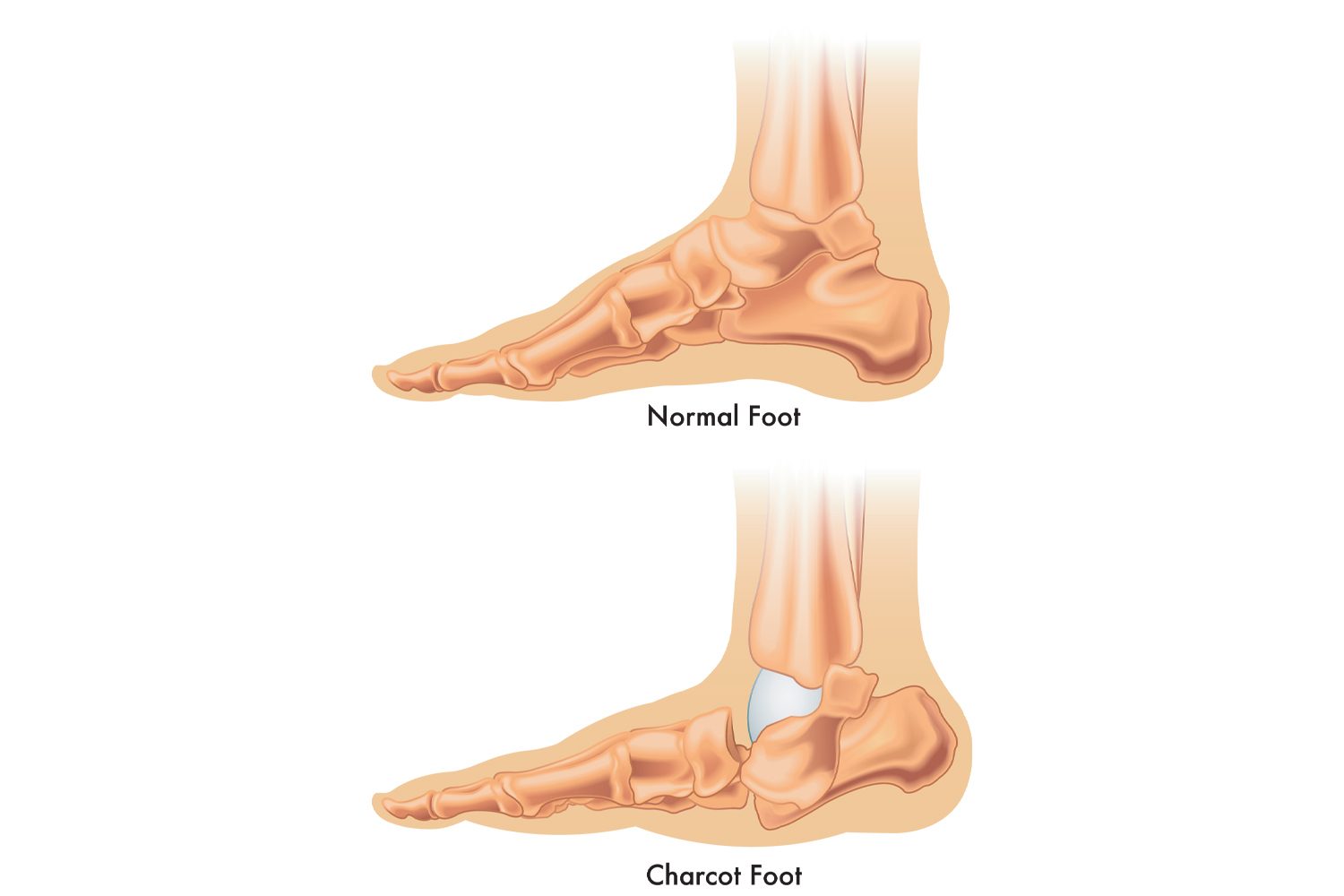 Foot and Ankle Specialists in Alabama – Southlake Orthopaedics